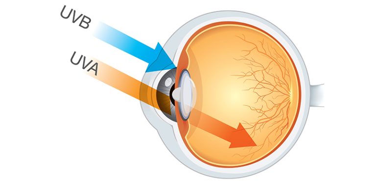 Shielding Your Eyes from Sun Damage | Cunningham Optical One